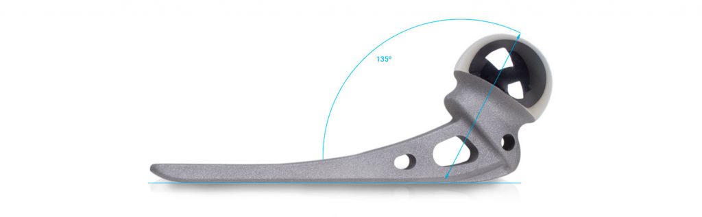 Austin Moore: Hip Hemiarthroplasty Treatment | Surgival