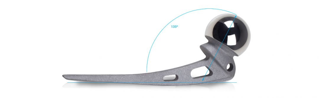 Austin Moore: Hip Hemiarthroplasty Treatment | Surgival