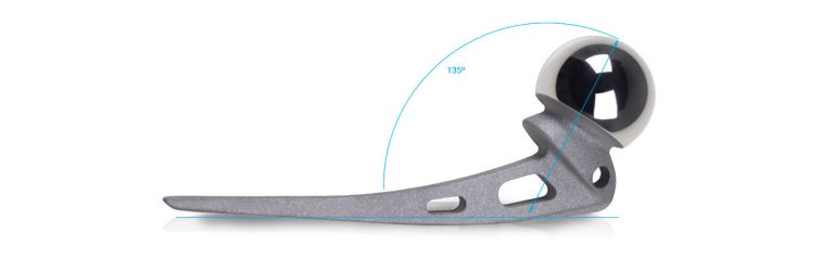Austin Moore: Hip Hemiarthroplasty Treatment | Surgival