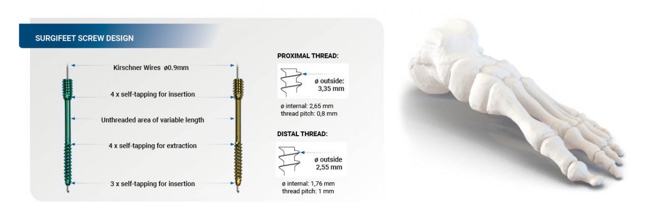 Surgifeet: Forefoot Reconstruction and Osteotomy System | Surgival
